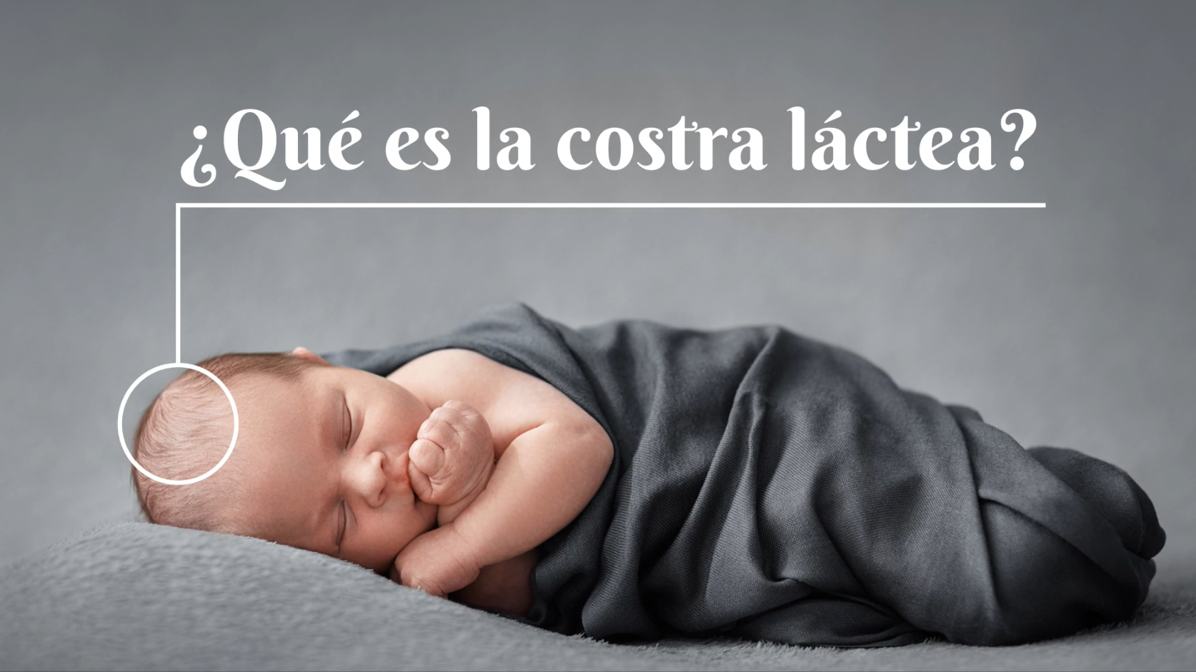 ¿Qué es la costra láctea?